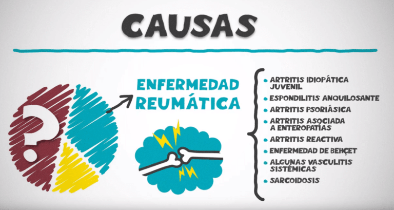 Uveítis: qué es, síntomas, diagnóstico y tratamiento