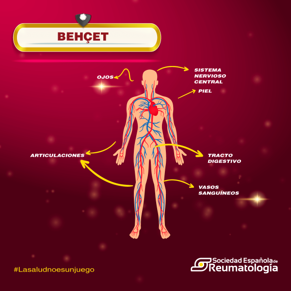 En España se estima que más de 2.300 personas sufren enfermedad de ...