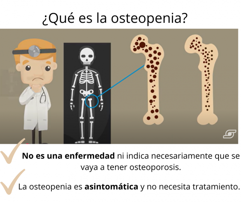 ¿Qué es la osteopenia? - Inforeuma